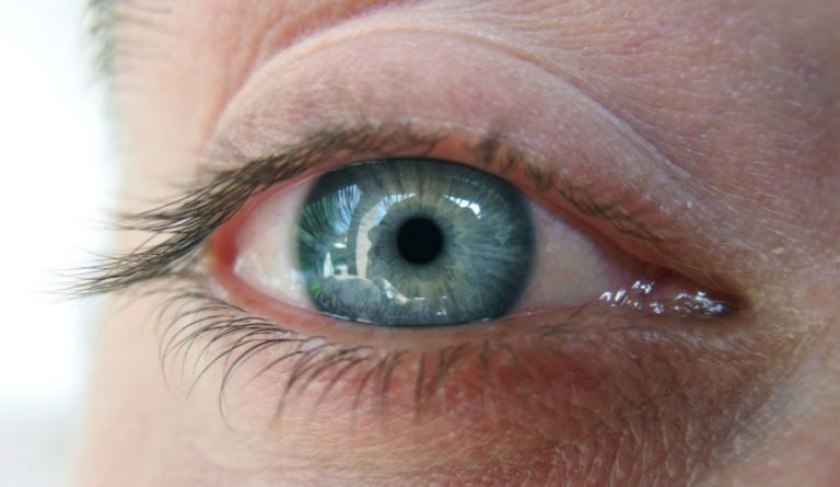 Otečene oči, zbadanje in solzenje – kako si lahko pomagate? | Dioptrija.si